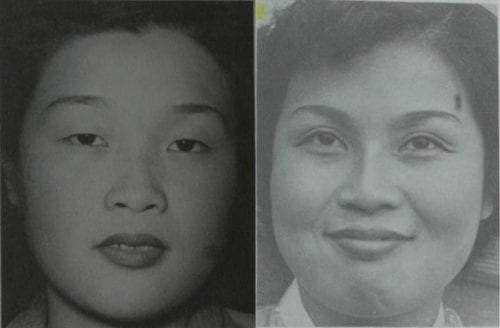 Korean American Plastic Surgery by Charles S. Lee, MD | Charles S. Lee, MD